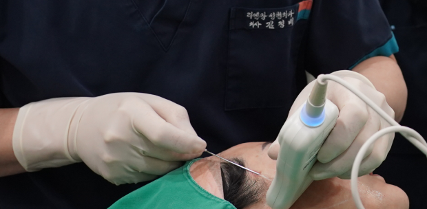 Ultrasound-Guided Thread Lifting - Lienjang Clinic Korea
